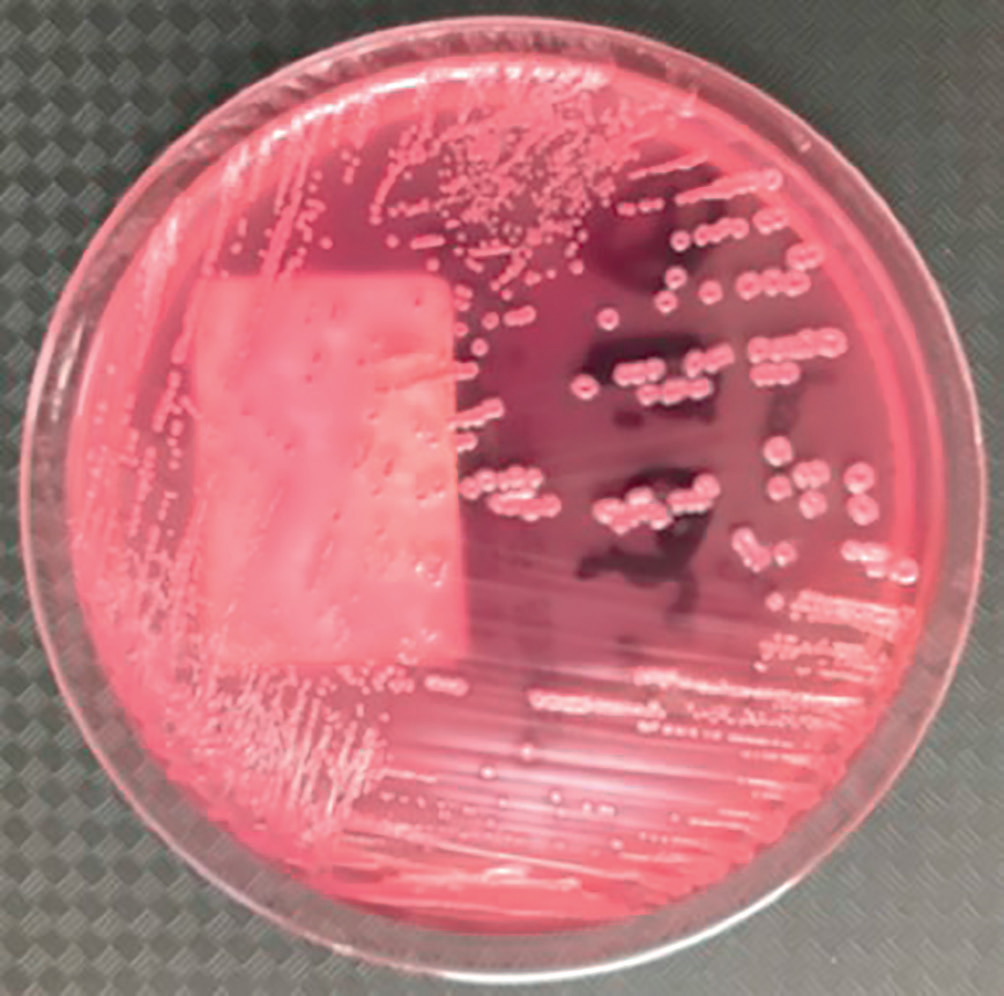 Escherichia Coli AEMiP