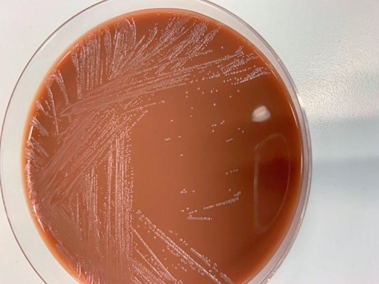 Haemophilus influenzae – AEMiP