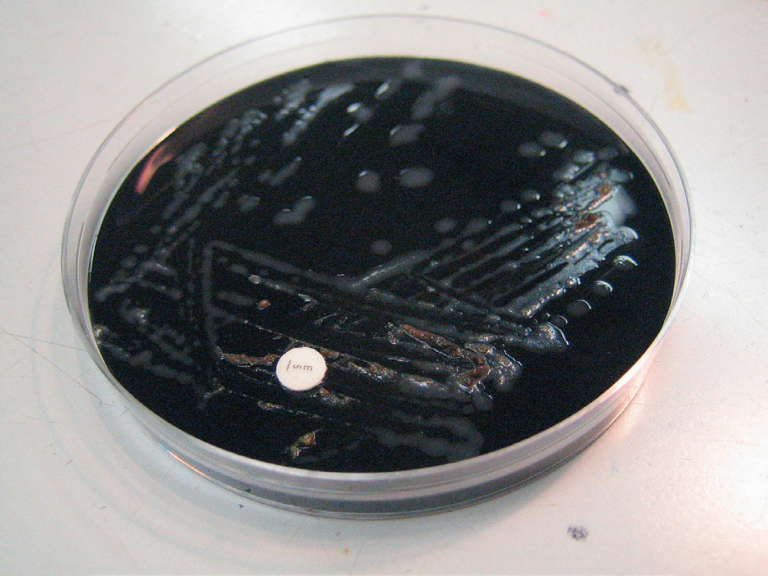 Campylobacter jejuni – AEMiP